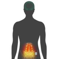 ReActiv8 | Restorative Neurostimulation | Australia